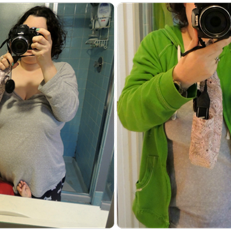 Not In Jersey My Abdominal Surgery Part 4 not-in-jersey-my-abdominal-surgery-part-4