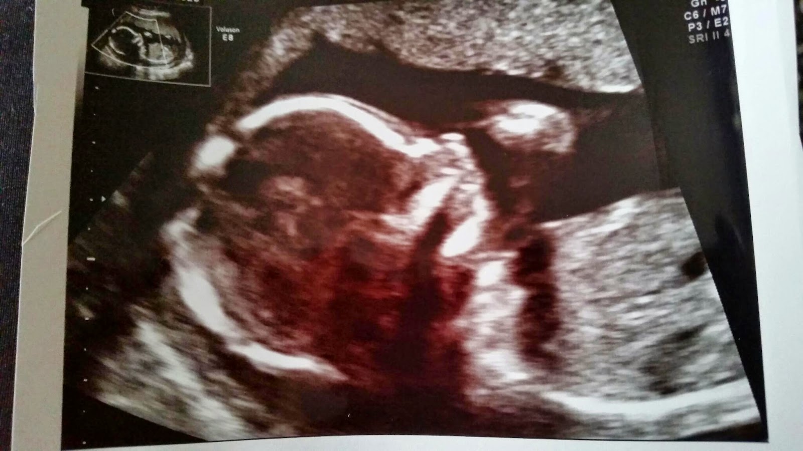 Amanda-07, William-08, Alexander-10,Wilda-11 o Lucas-13.: Bild på bebis ...