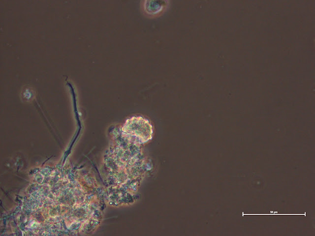Aspidisca costata и Aspidisca sulcata: aspidisca — LiveJournal