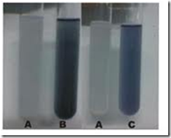 KOLEKSI TUGASAN: MIKROBIOLOGI - UJIAN FERMENTASI GULA, UJIAN OKSIDASE ...