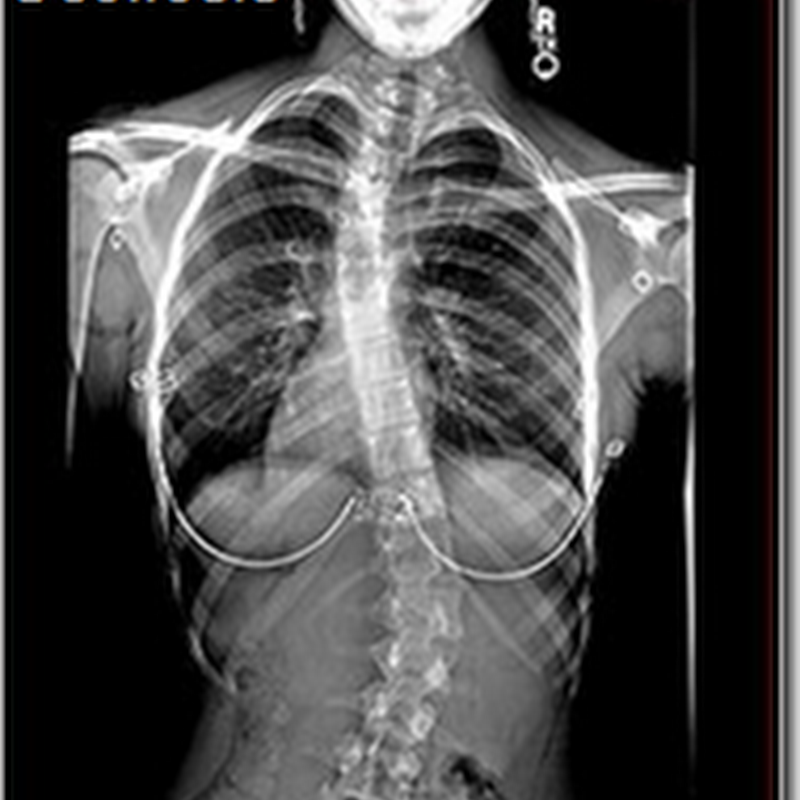 CVS Examination-Cardiac Examination-With Symptoms Analysis | MedicoTips.Com