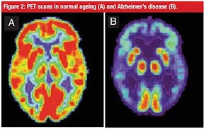 MedRead: Dementia lab screening