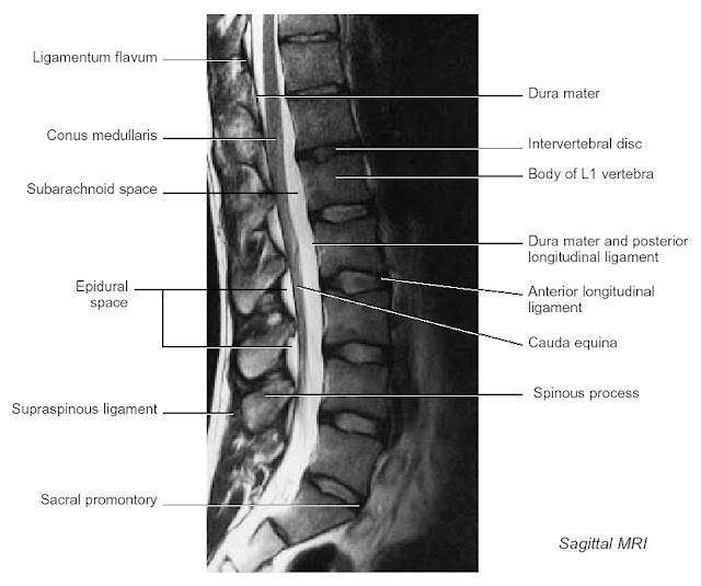 Stellaaaaa?!: July 2013