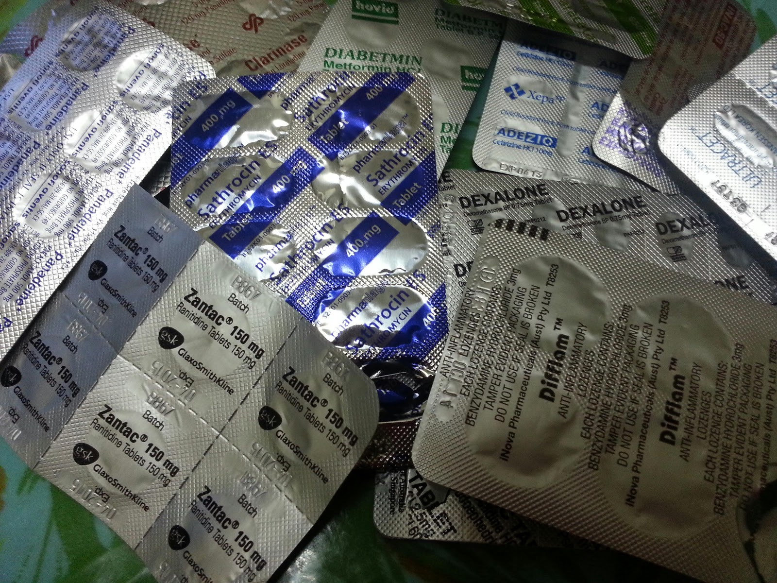 What's Up Izang!: Ubat moden atau tradisional?