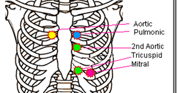 Cardiac Murmurs. Types of Murmurs.