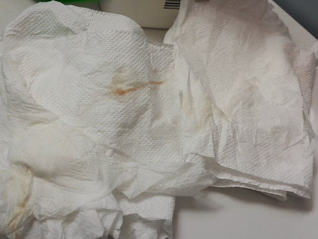 Waiting For Our Little Sprouts: Blood !!! [Beware, disgusting image]