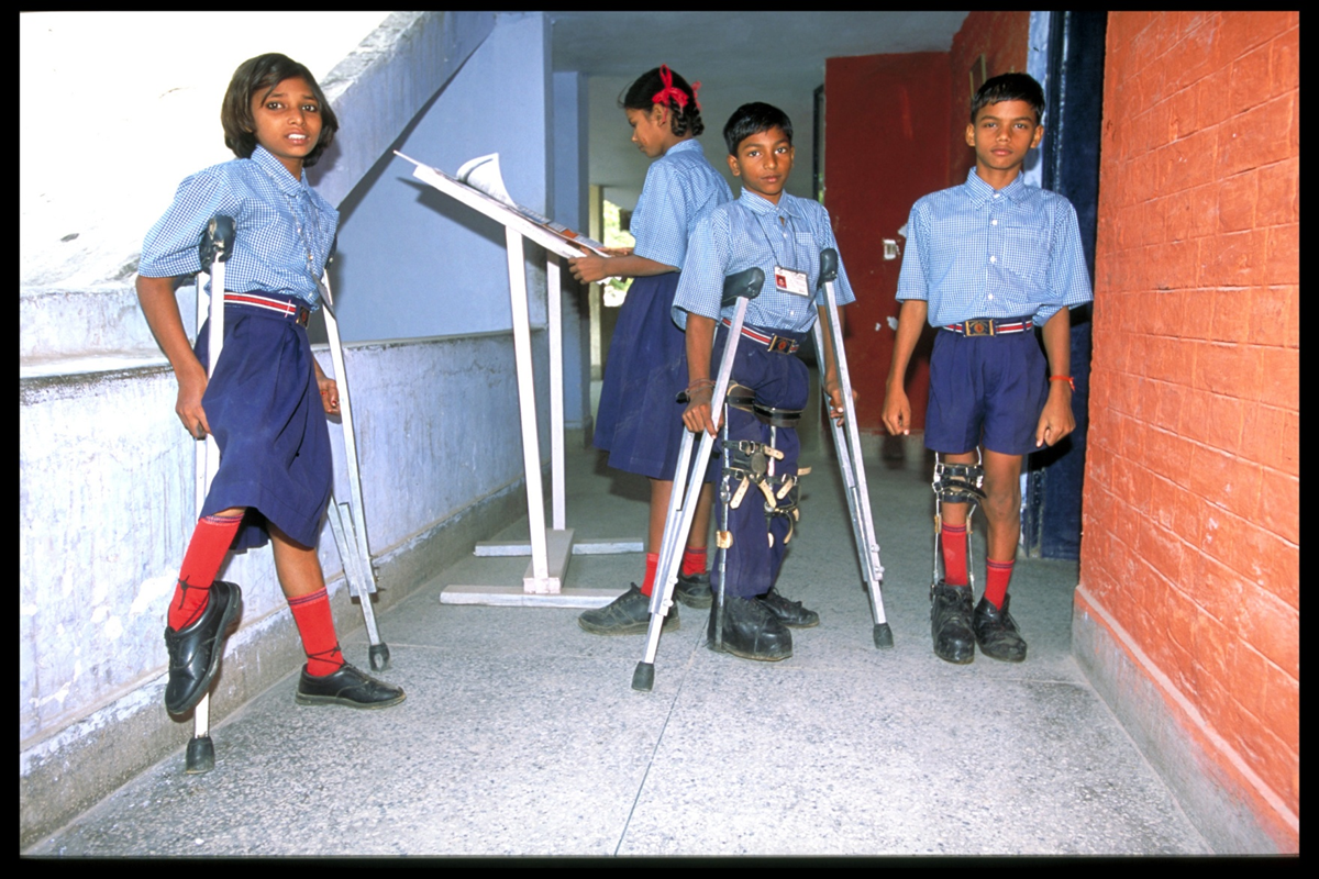 Causes And Symptoms Of Polio | NewsDrift