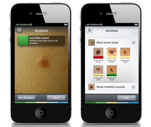 Alizul: SKINVISION: THE APP THAT TURNS YOUR SMARTPHONE INTO A SKIN ...