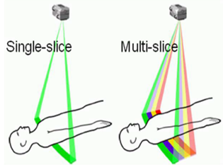 Imagenologia parte II - Tomografia Computadorizada | Biomedicina Padrão