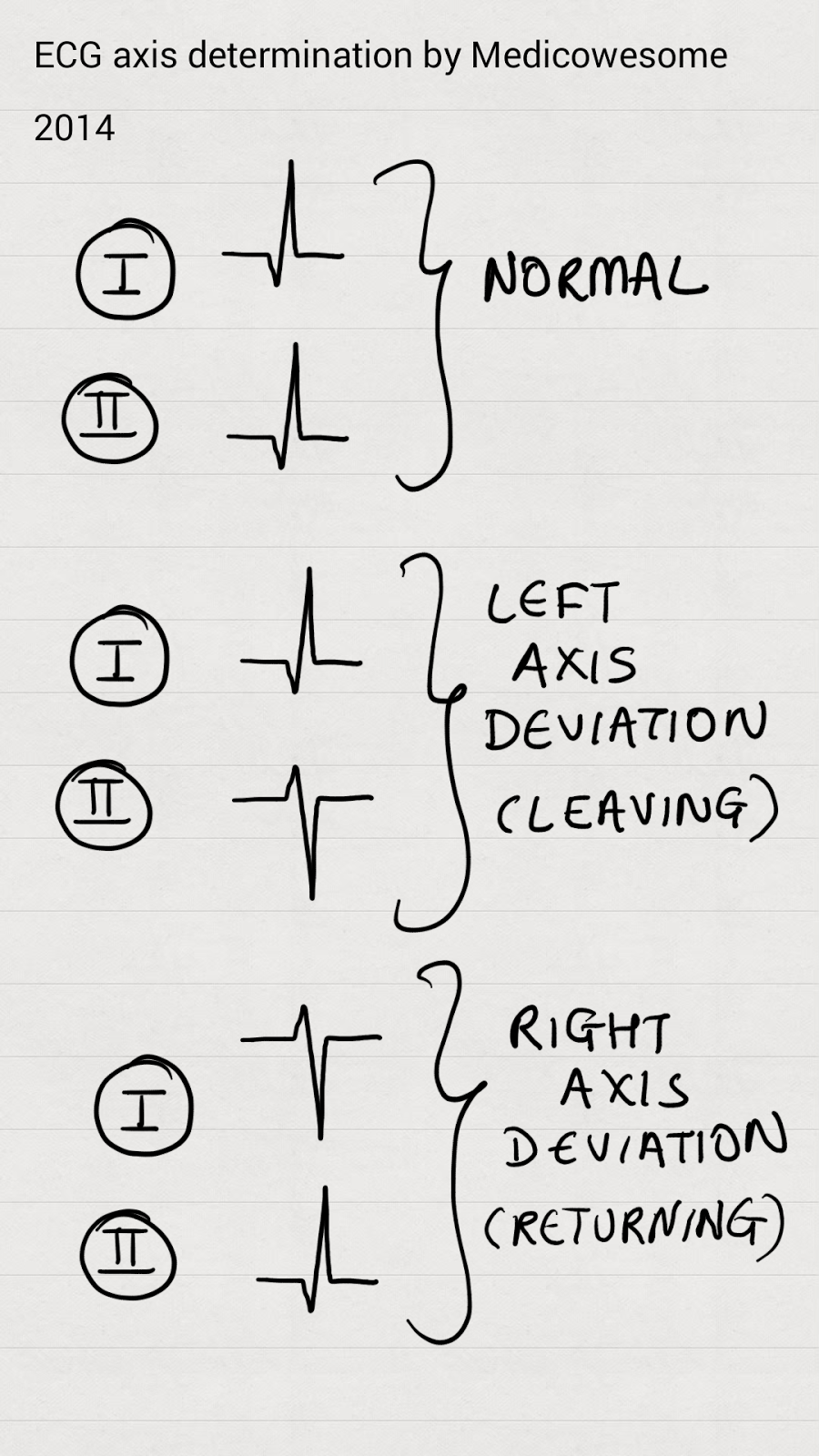 Ecg Axis Deviation Chart EKG Anatomy Axis from Life In The Fast Lane