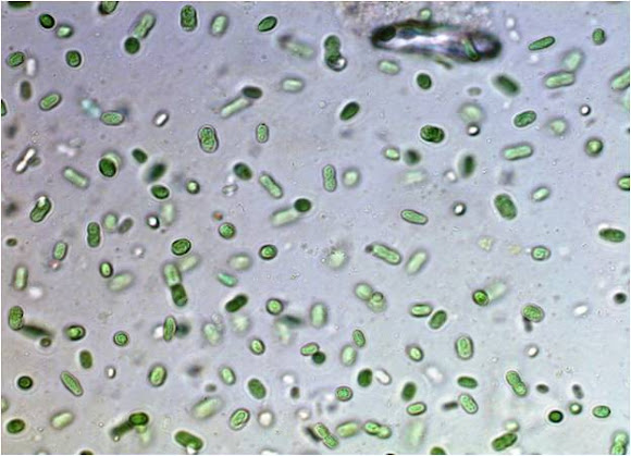 Dunaliella | Project Noah