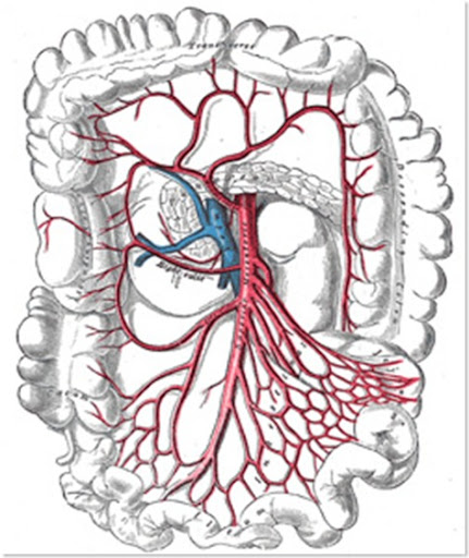 Aneurisma Aorta ~ Seputar Kedokteran