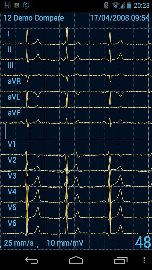 Cardiax Mobile ECG - Android Apps on Google Play