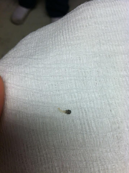 Human bot fly (larva) | Project Noah