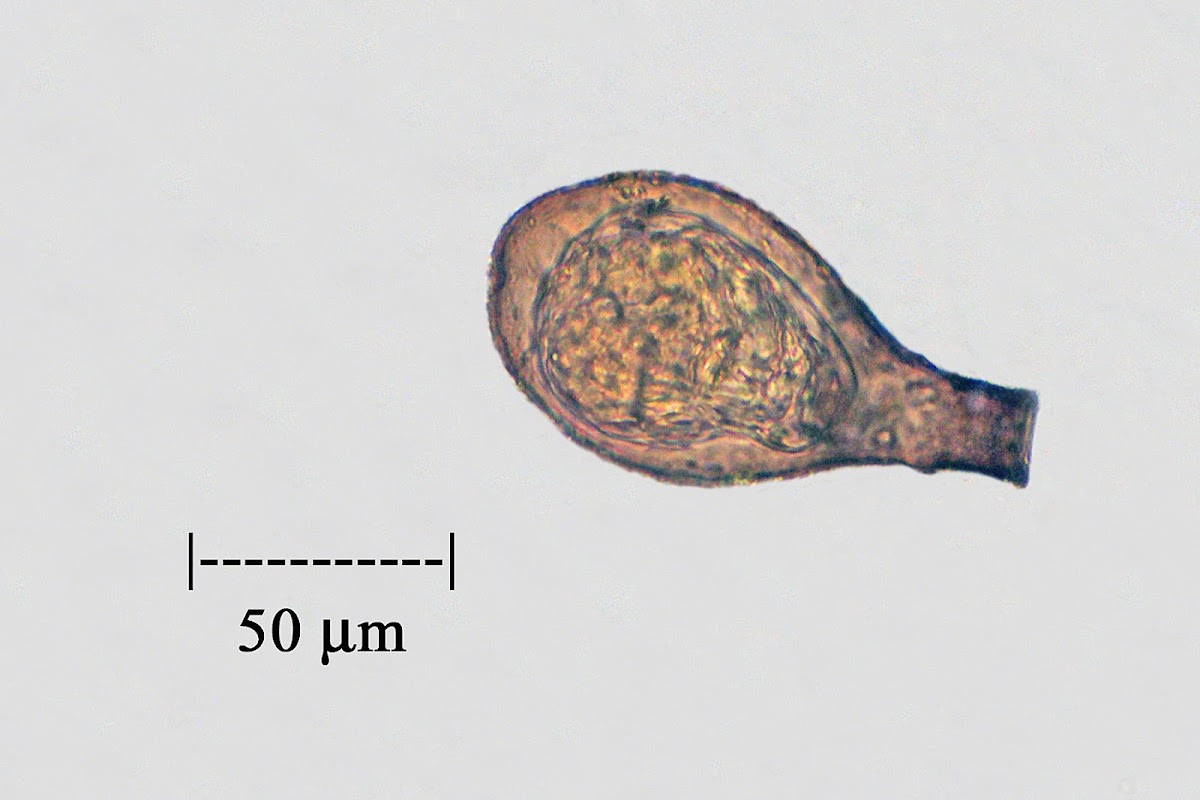 Difflugia | Project Noah