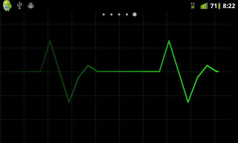 Download Ecg Rhythms Live